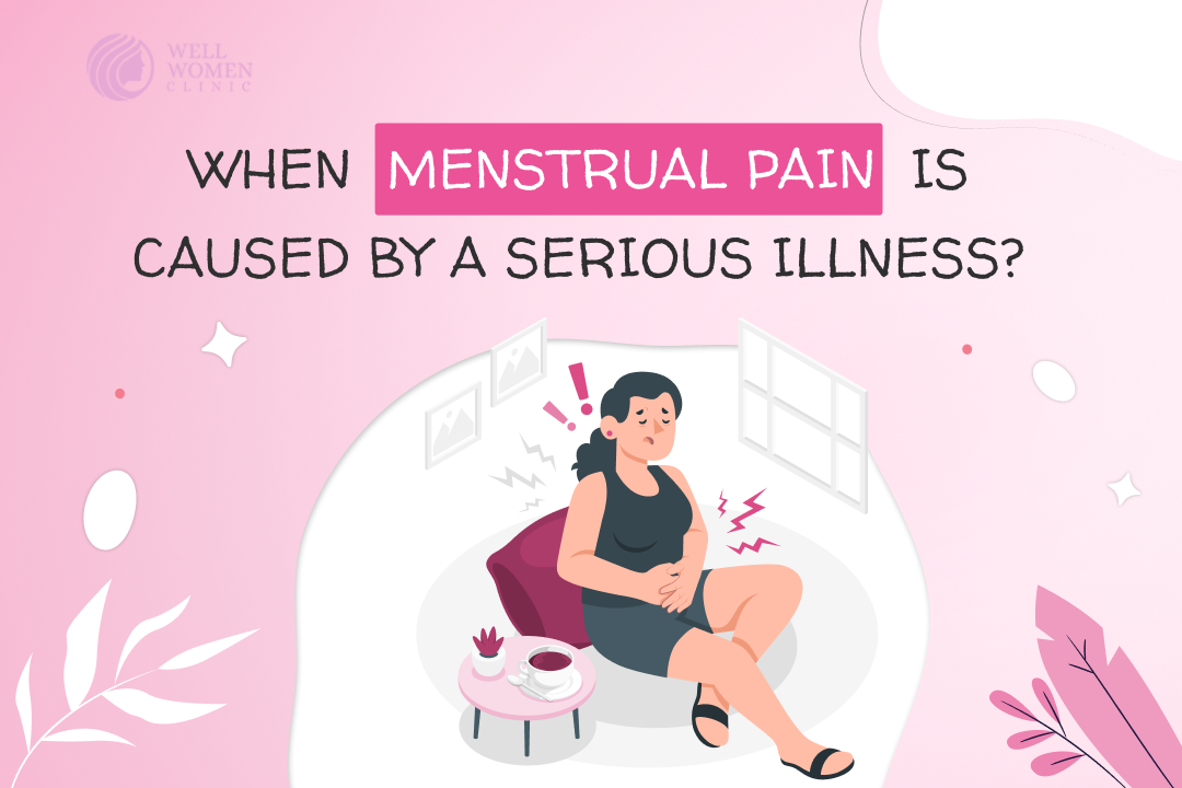 When Does a Severe Illness Caused By Menstrual Pain?
